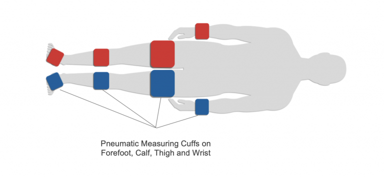 PVR – Pulse Volume Recording - Vascular Academy | powered by SOT