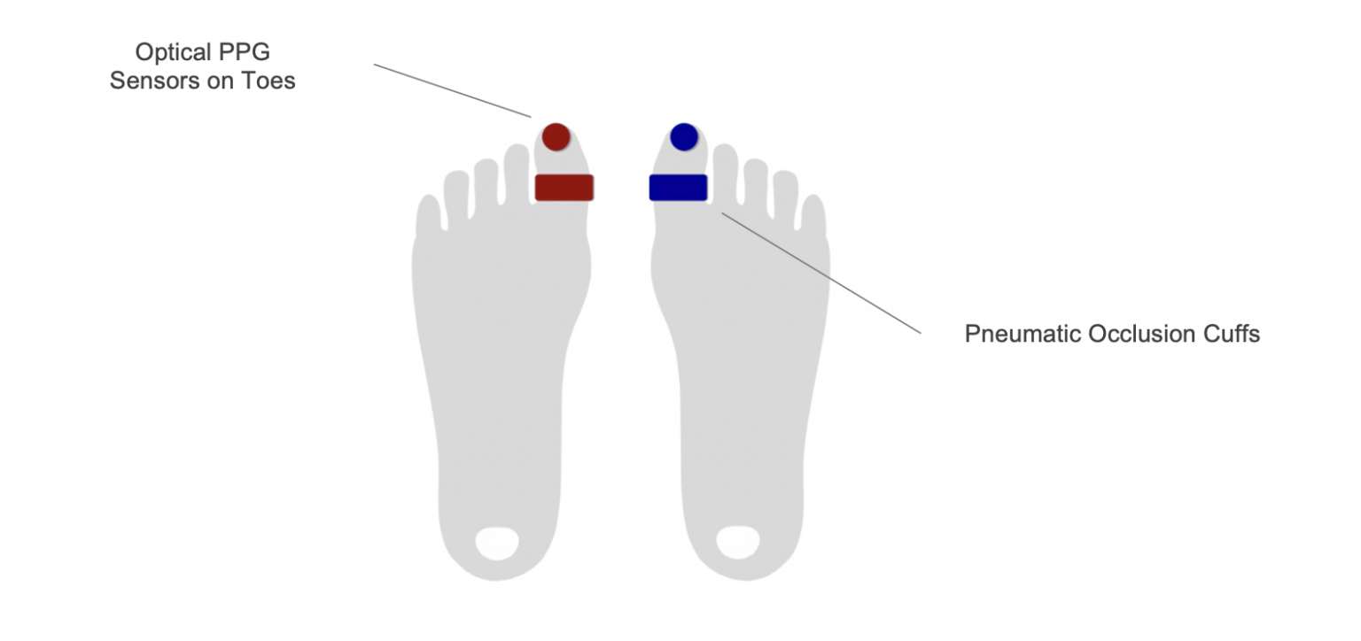 OAP – Optical Arterial Pressure - Vascular Academy | powered by SOT