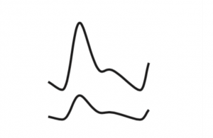 Pulse Wave Parameters - Vascular Academy | powered by SOT