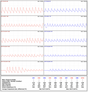 TOS-Test (Thoracic Outlet Syndrome) - Vascular Academy | powered by SOT