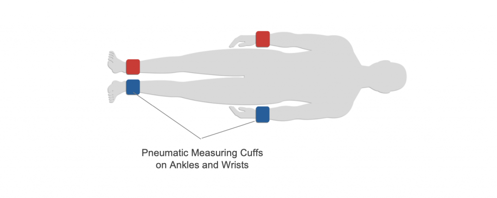 PVR – Pulse Volume Recording - Vascular Academy | powered by SOT