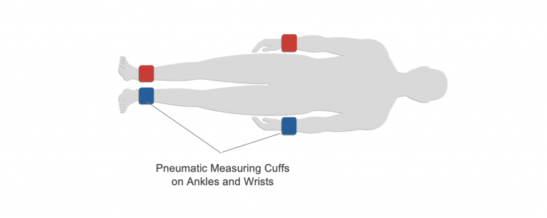 PVR – Pulse Volume Recording - Vascular Academy | powered by SOT