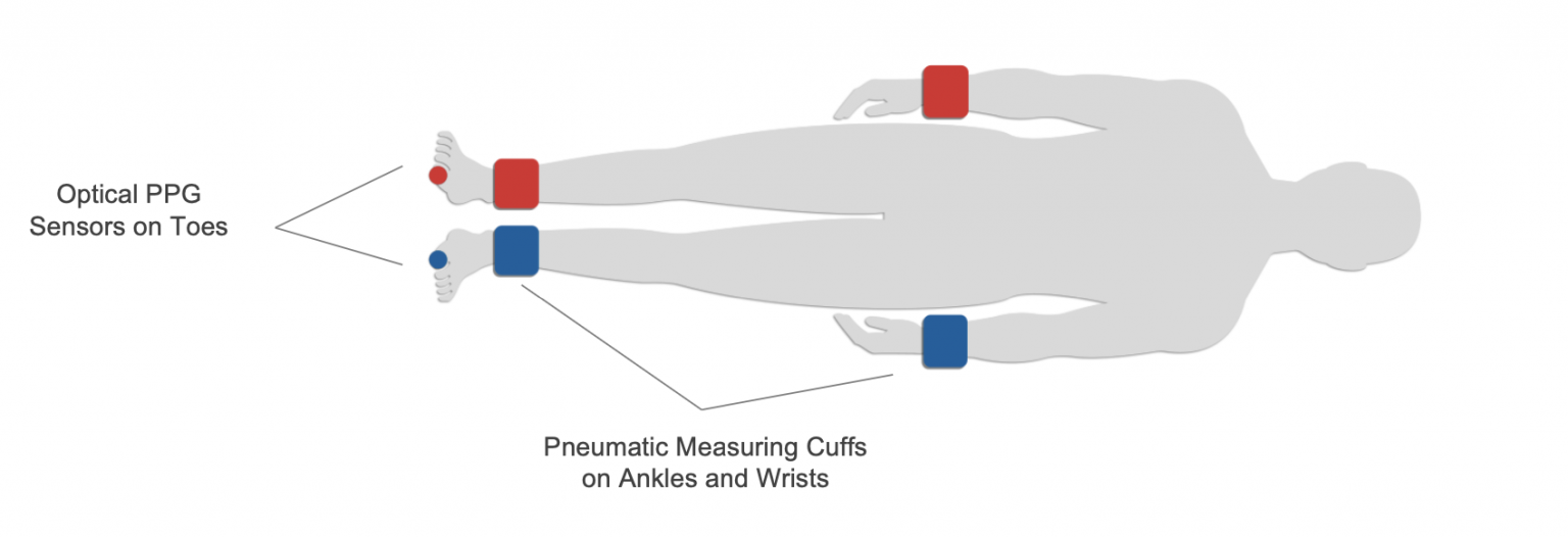 TOPP-Method (Tissue Optical Perfusion Pressure) - Vascular Academy ...