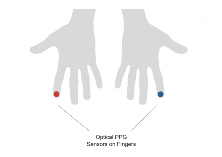 TOS-Test (Thoracic Outlet Syndrome) - Vascular Academy | powered by SOT